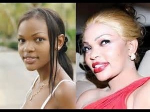 Dangers Of Skin Bleaching